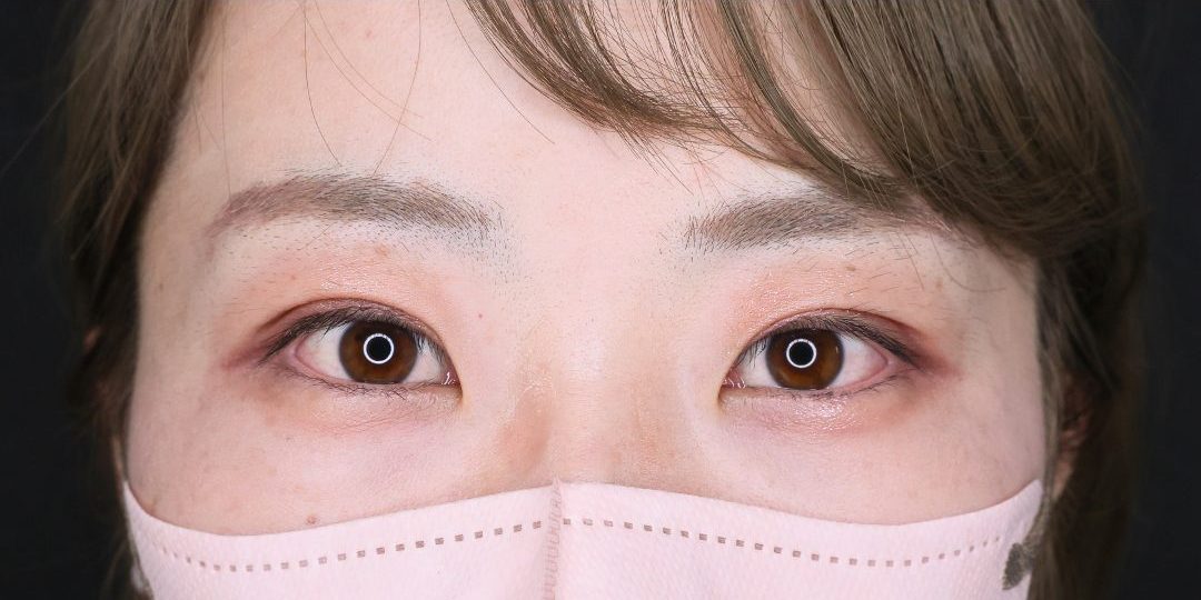 20代 女性 | 一宮美容クリニック